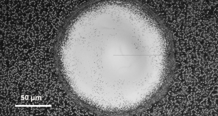 Laser Structuring - Laser Micromachining - 3D-Micromac AG